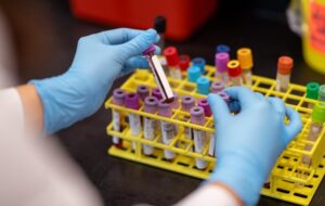 Lab Draws and Testing - Watertown Family Practice